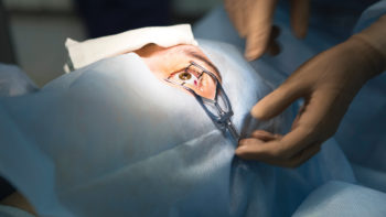 Complications After LASIK Surgery | CollaborativeEYE
